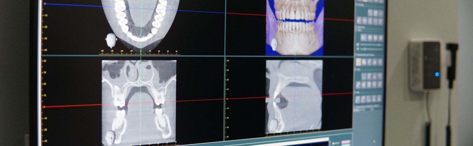 Dr. Frank M Kerbl Fairhope AL, Southern Endodontics